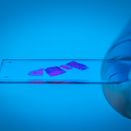 Source BioScience acquires Cambridge Clinical Laboratories