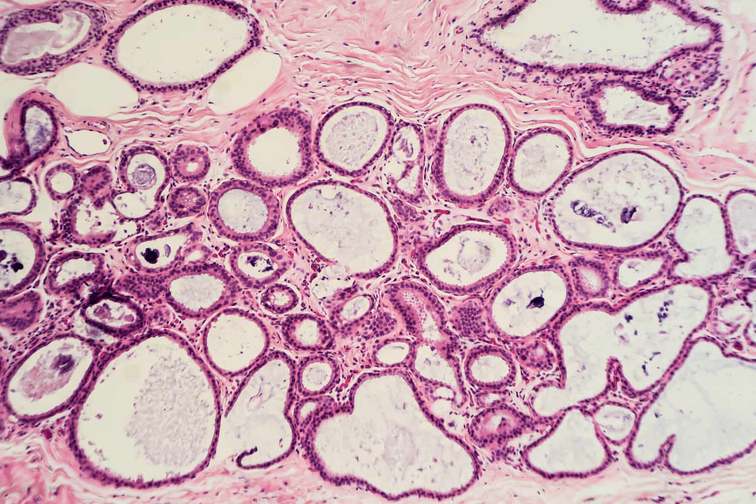Cellular Pathology Services | NHS | Histopathology